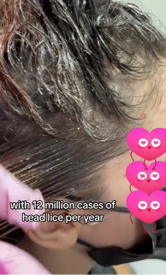 LICE-A-GEDDON™: The Stats | Lice Ladies